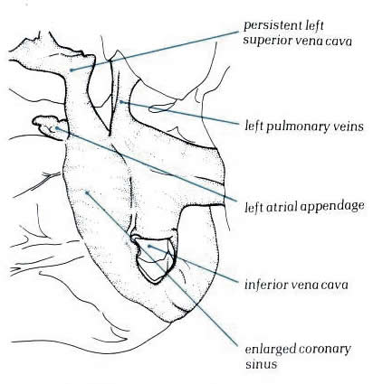 Anatomy of the Heart